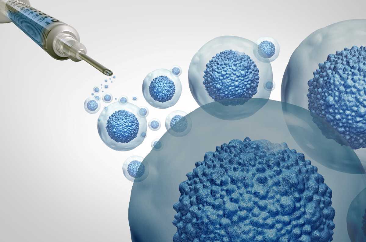 Lutut Kembali Nyaman Setelah Injeksi Secretome